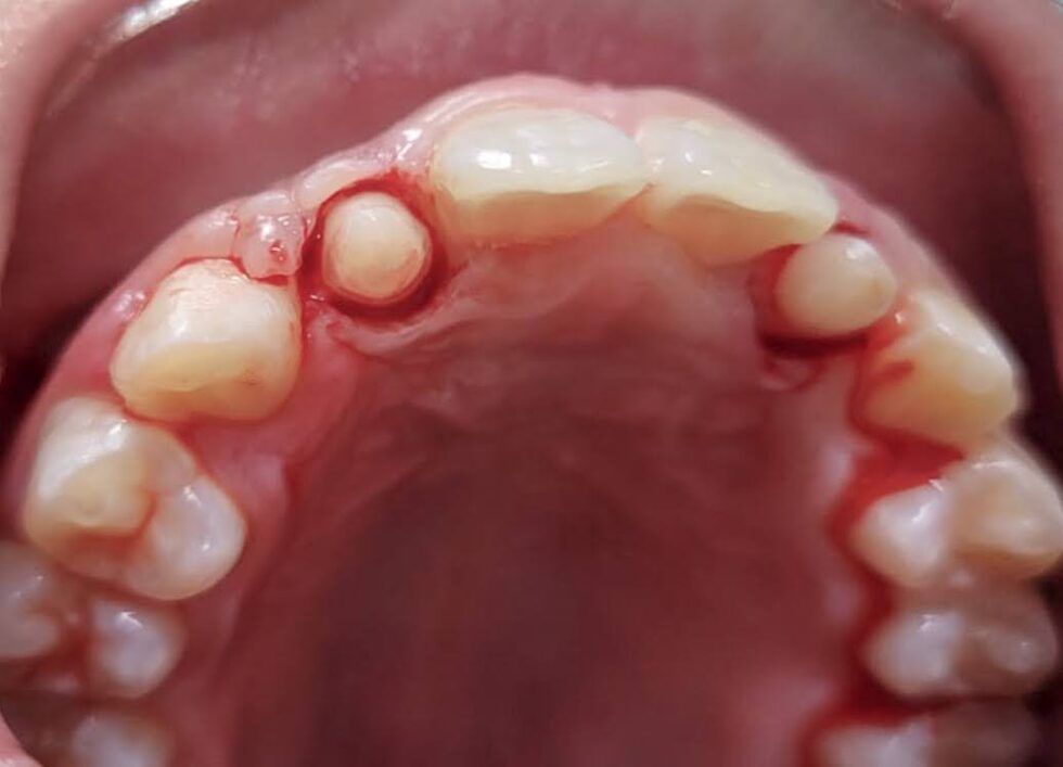 Blog l Autrán Dental Academy