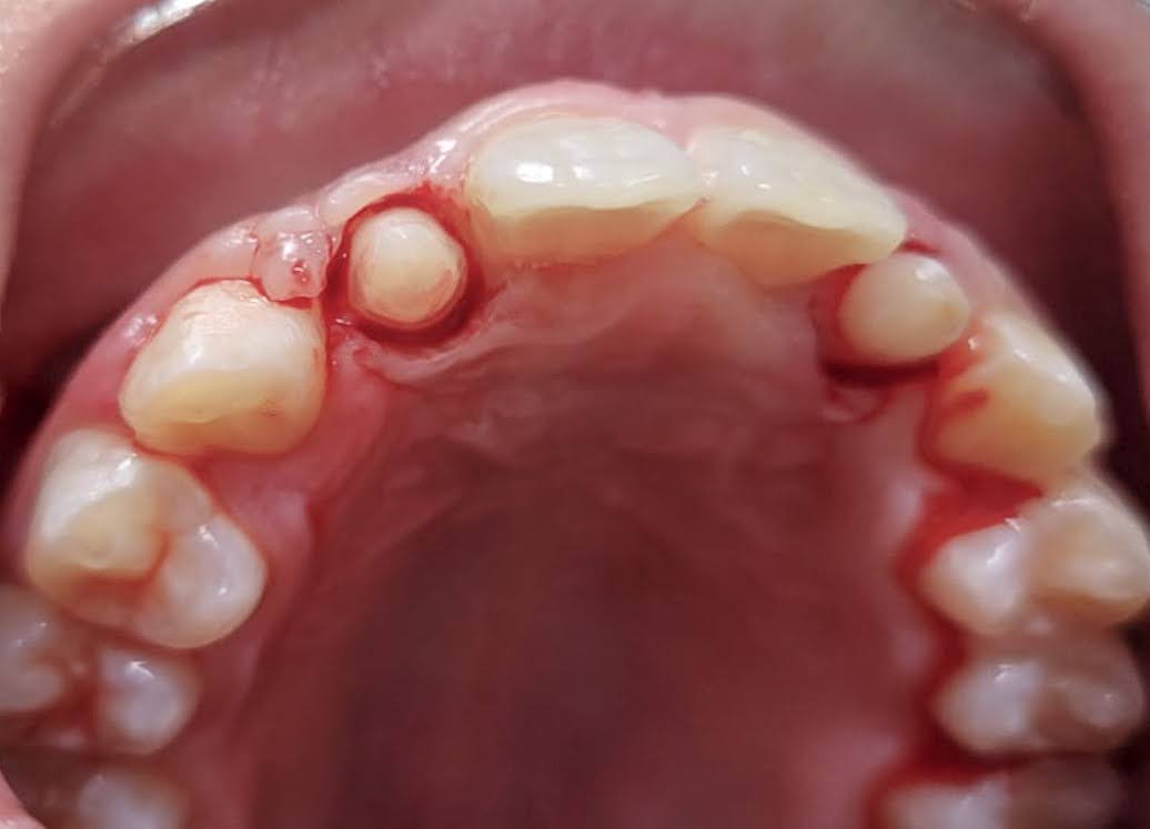 Blog l Autrán Dental Academy